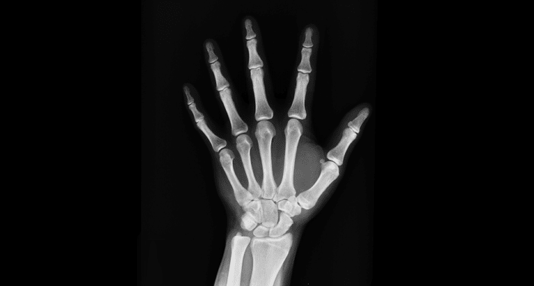 Quel physicien a réalisé la première radiographie en 1895 ? - Alea Quiz